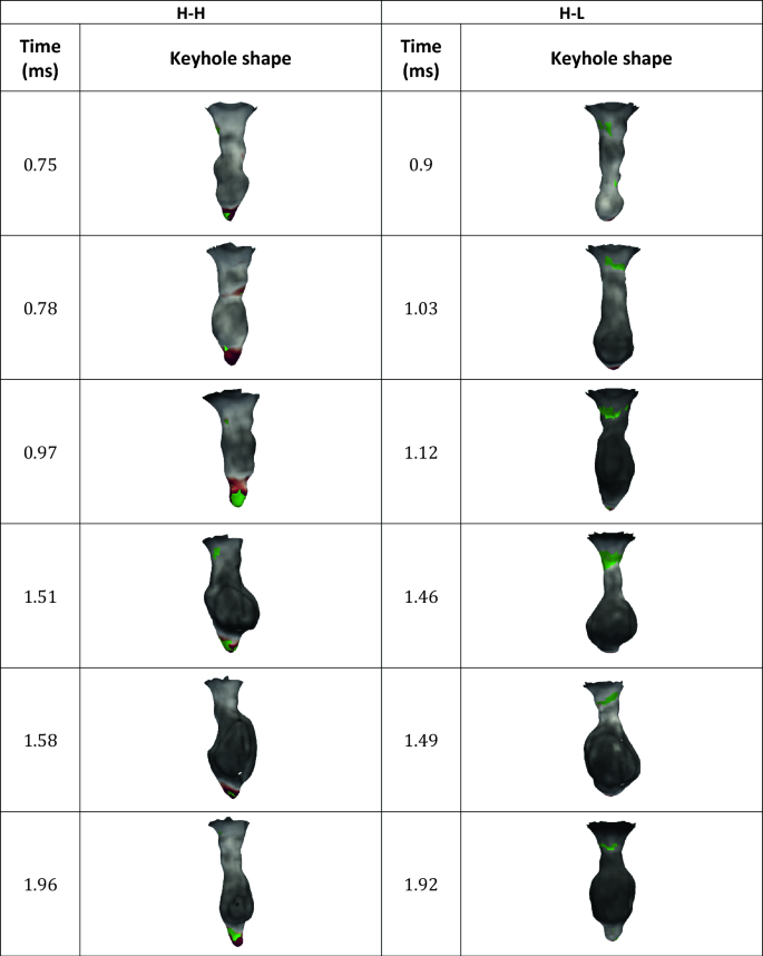 High fidelity multi-physics modeling of laser metal interaction and ...