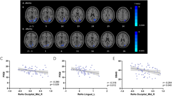 Static and temporal dynamic alterations of regional homogeneity in ...