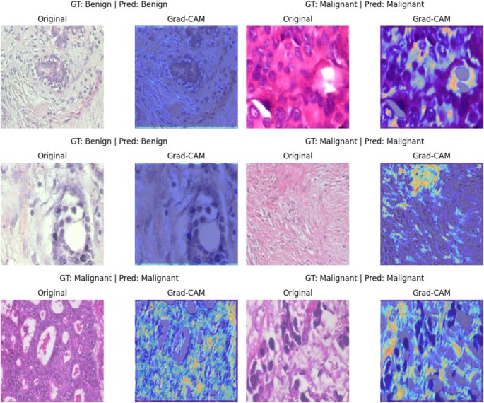 Fusion of Vision Transformer and Convolutional Neural Network for ...