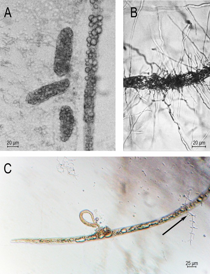 Fungal endophytes from wild Solanum torvum seeds: diversity and ...