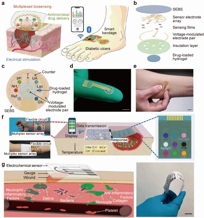 Real-time Monitoring of Wound Infection Based on Multi-channel ...