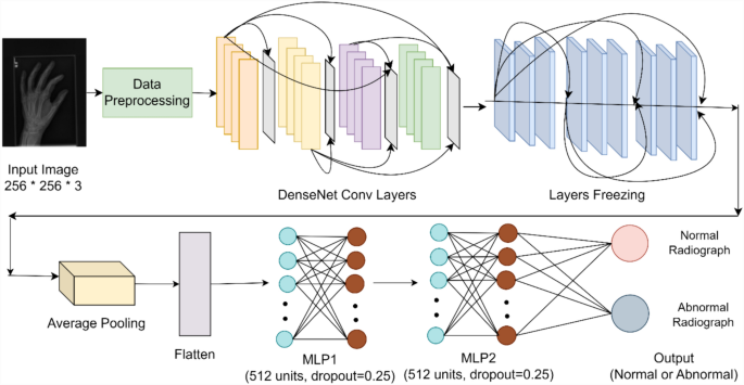 Assessing radiographic findings on finger X-rays using an enhanced deep ...