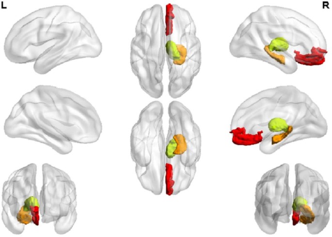 The study of altered brain structure in preterm infants with low grade ...