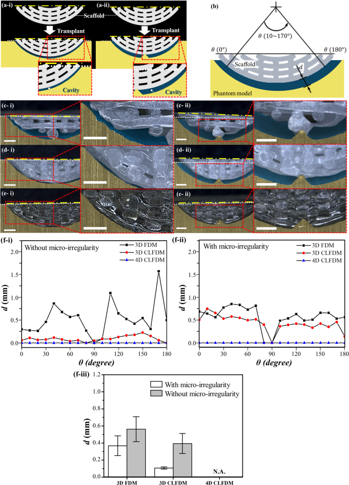 Bone Regeneration Efficacy and Applicability of Defect-Fitting 4D ...