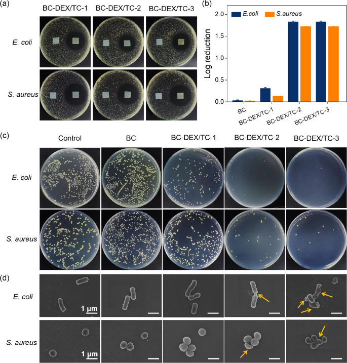 A drug-loaded flexible substrate improves the performance of conformal ...