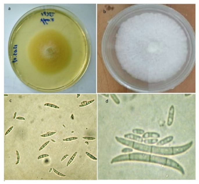 Quarantine evaluation of Didymella bryoniae in cucurbits from Iran ...