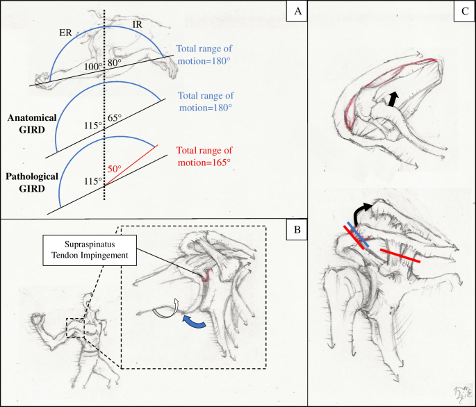 Identifying Acute and Overuse Injuries of the Shoulder in Pediatric ...