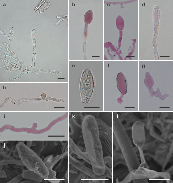 Novel powdery mildew of cotton (Gossypium hirsutum) caused by ...