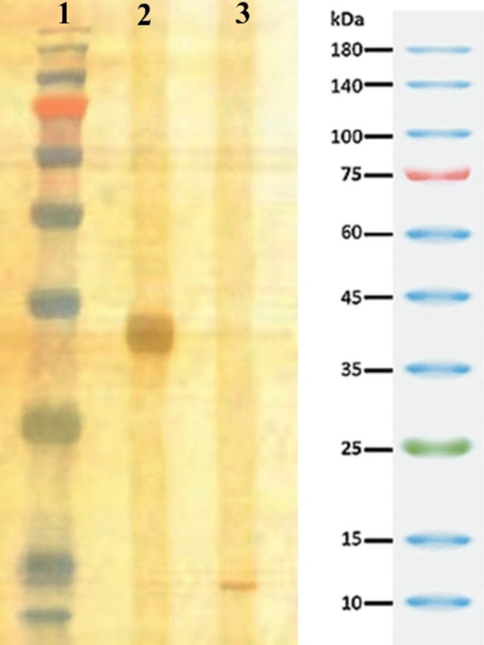 Optimizing proinsulin production in E. coli BL21 (DE3) using taguchi ...