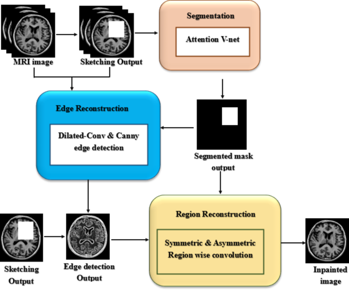 Brain Magnetic Resonance Image Inpainting via Deep Edge Region-based ...