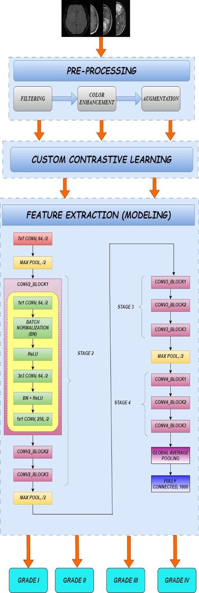Glioma Grading Unveiled: Optimizing Classification with Multi-Scale Fusion and Self-Supervised ...