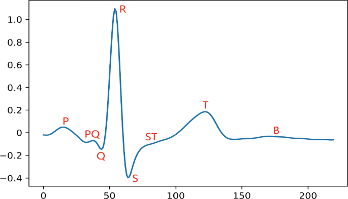 An ECG Segmentation Method Based on GMM and Clusterwise Regression | Communications on Applied ...