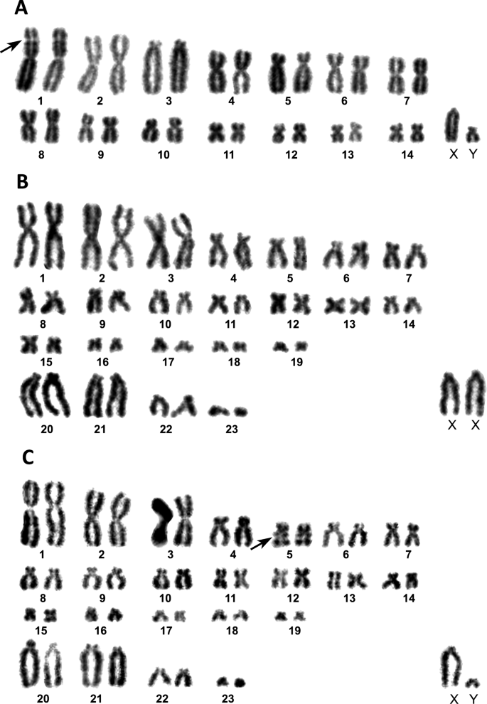 The hidden diversity in Thrichomys Trouessart, 1880 (Rodentia ...