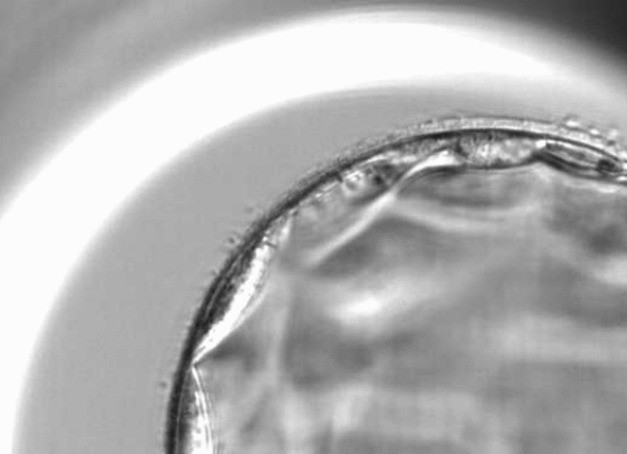 Inner Cell Mass Grade and Earlier Blastulation Are Associated with ...