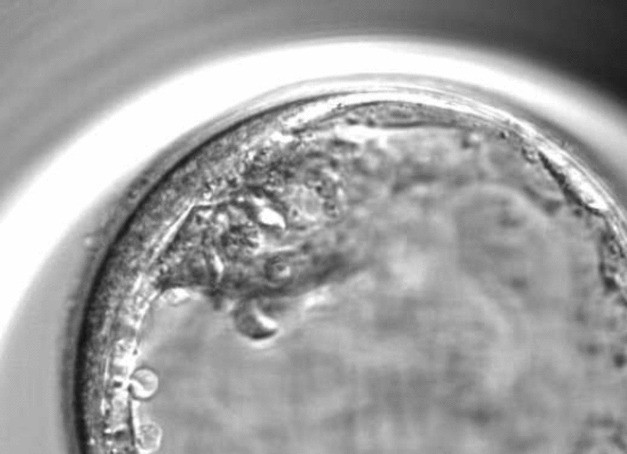 Inner Cell Mass Grade and Earlier Blastulation Are Associated with ...