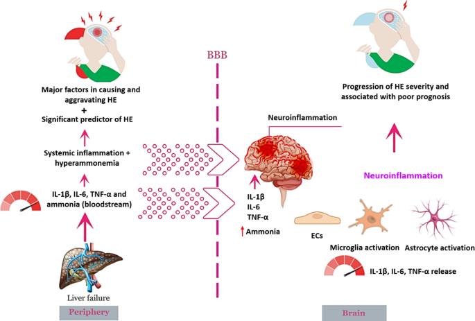Current advances in the management of hepatic encephalopathy: an ...