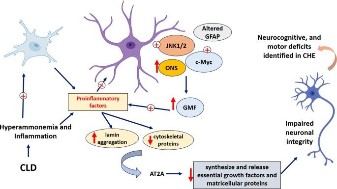Current advances in the management of hepatic encephalopathy: an ...