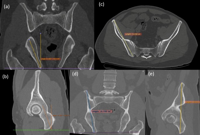 Design and Validation of a 3D-Printed External Aiming Jig for ...