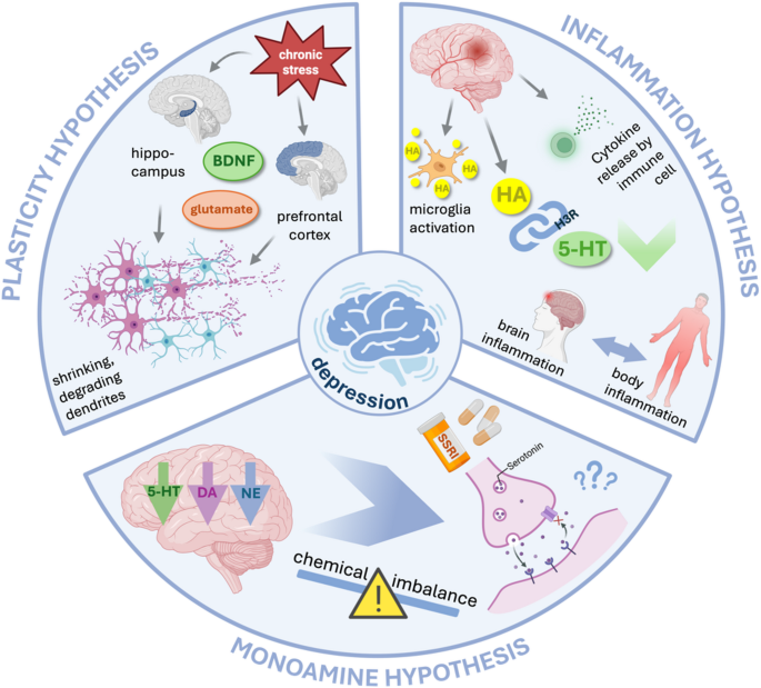 How three different theories of depression converge at inflammation ...