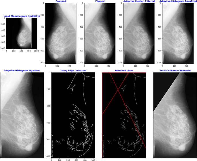 Multi-class Breast Cancer Classification Using CNN Features ...