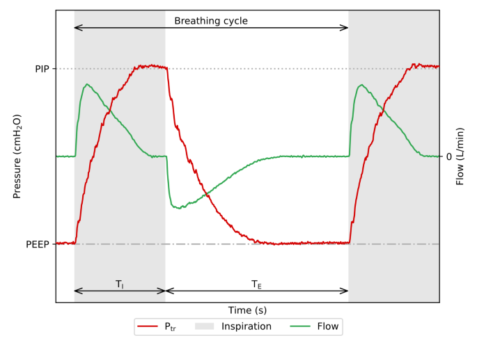 Influence of inspiratory resistors on tracheal pressure during ventilation with decelerating ...