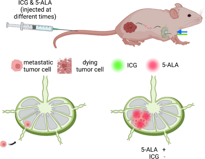 Dual-tracer fluorescence imaging and surgical resection of metastatic ...