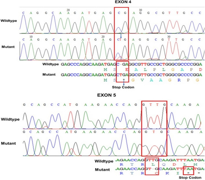 RUNX1 alterations and survival outcomes in AML: leukocyte dynamics and thrombocytosis insights ...