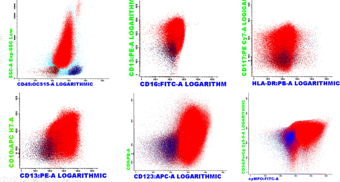 Acute promyelocytic leukemia: the first reported case diagnosed by ...