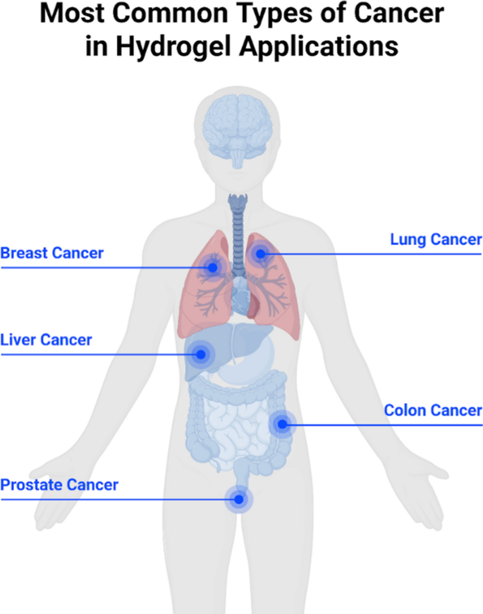 Hydrogel applications in tumor microenvironment modeling | Discover ...