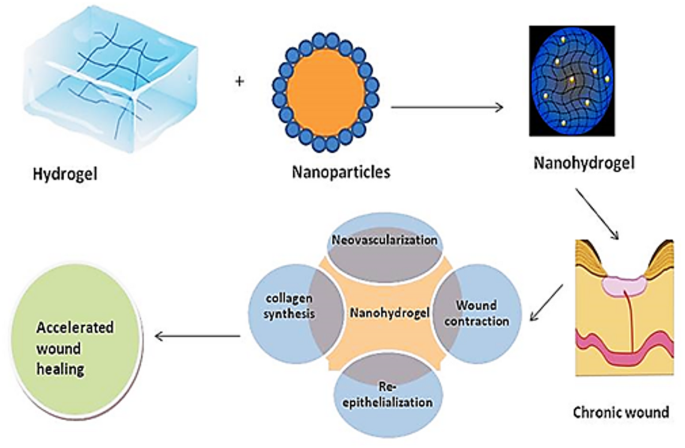 Enhancing wound healing with nanoparticle-infused hydrogels: a review ...