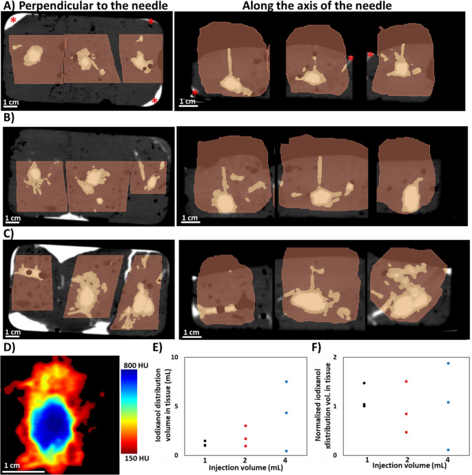 Mapping drug distribution using CT imaging following direct tissue ...