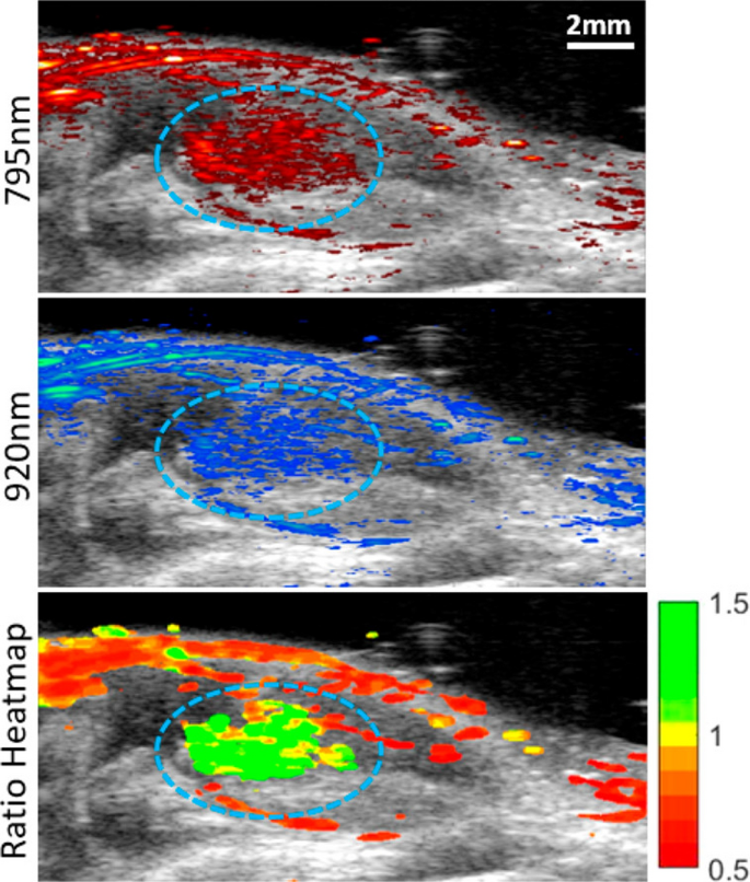 An insight into photoacoustic imaging in regenerative medicine ...