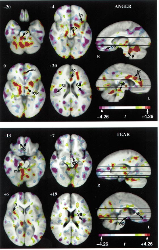 Subcortical and cortical brain activity during the feeling of self ...