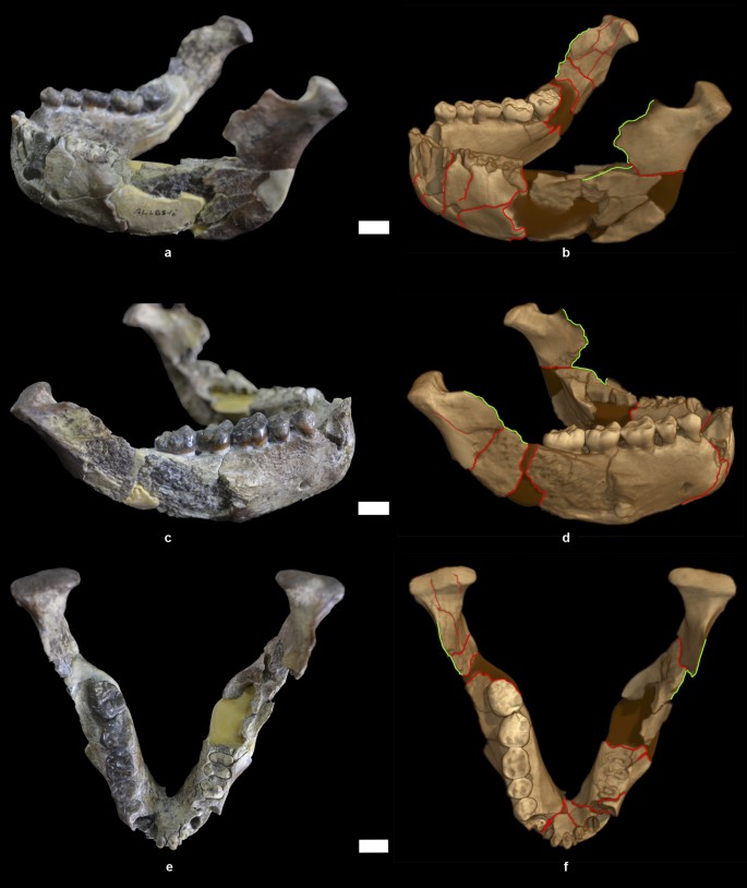 Perimortem fractures in Lucy suggest mortality from fall out of tall ...