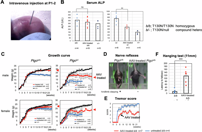Biosynthesis of GPI anchored proteins, its deficiencies and treatment ...