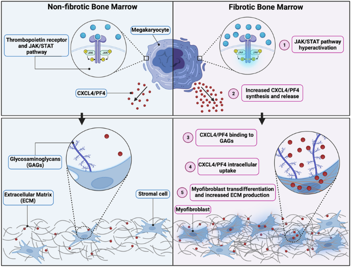 Proteomic screening identifies PF4/Cxcl4 as a critical driver of ...