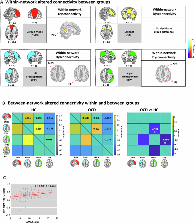 Dysregulated connectivity configuration of triple-network model in ...