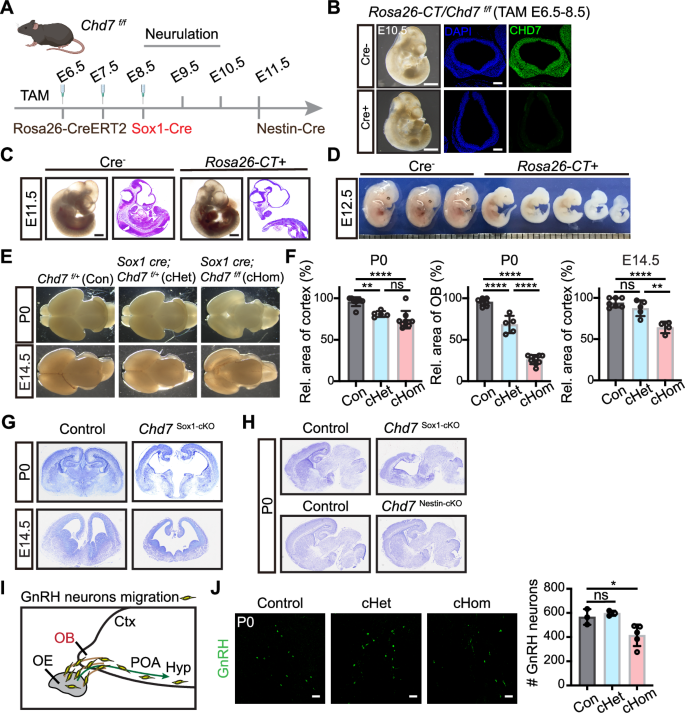 Mutation of CHD7 impairs the output of neuroepithelium transition that ...