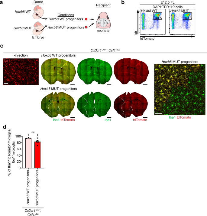 Defective Hoxb8 microglia are causative for both chronic anxiety and ...