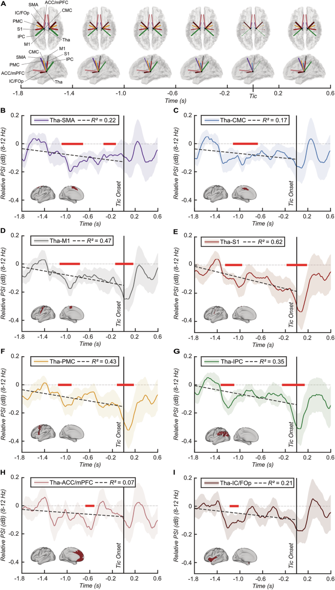 Thalamo-frontal functional connectivity patterns in Tourette Syndrome ...