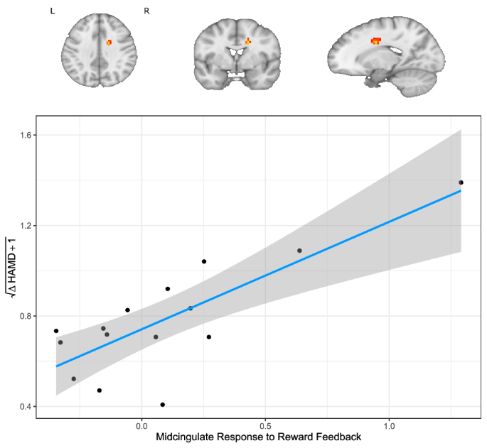 Reward circuit function and treatment outcome following vALIC deep ...