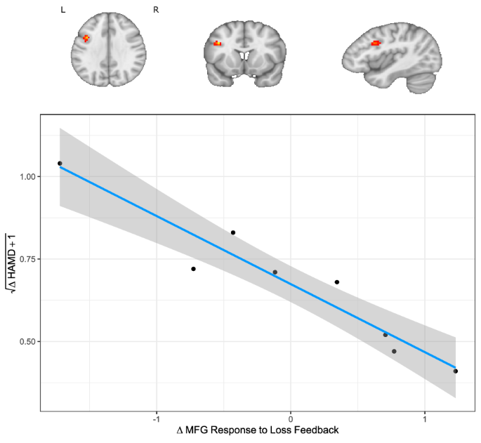 Reward circuit function and treatment outcome following vALIC deep ...