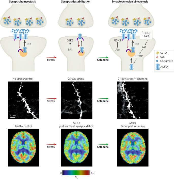 Challenges and rewards of in vivo synaptic density imaging, and its application to the study of ...