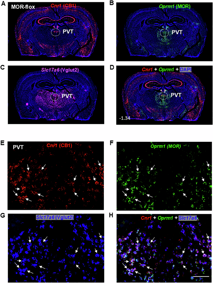 Cannabinoid CB1 receptor and mu-opioid receptor interaction: new ...