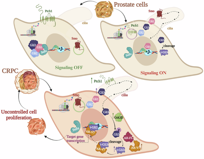 Oncogenic potential of truncated-Gli3 via the Gsk3β/Gli3/AR-V7 axis in ...
