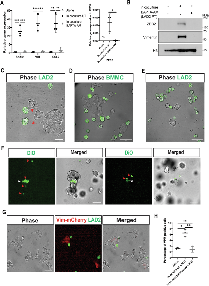 Mast cells interact directly with colorectal cancer cells to promote ...