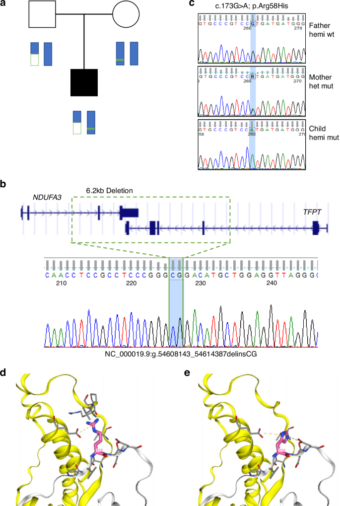 Identification of novel NDUFA3 variants in a patient with mitochondrial ...