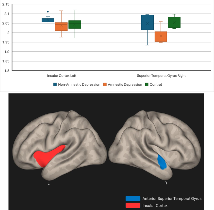 Subjective cognitive decline in major depressive patients is associated ...