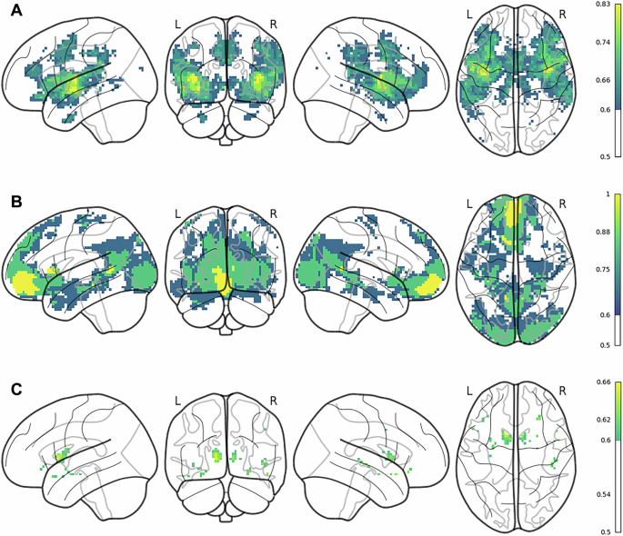 Brain network localization of structural and functional abnormality associated with aggression ...