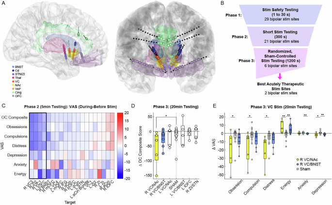 Invasive brain mapping identifies personalized therapeutic ...